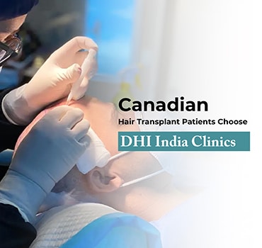 Why Canadians Choose DHI India for Best Hair Transplant